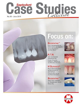 Biodentine™ - Septodont